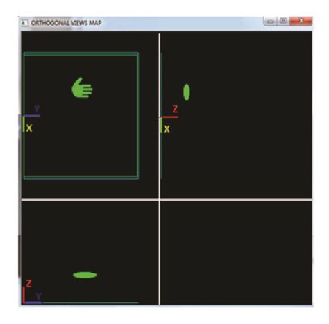 screens of the image processing module to locate the bracelet bracelet