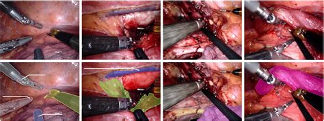 논문 리뷰 Benchmarking Pretrained Attention Based Models For Real Time Recognition In Robot