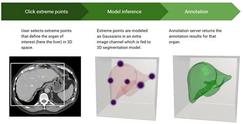 fast ai assisted annotation and transfer learning powered by the clara