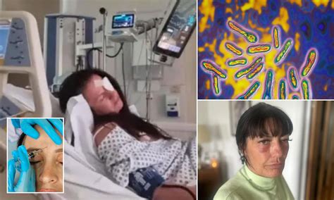 Warning Over Spate Of Deadly Fake Botox Injections In Uk Region