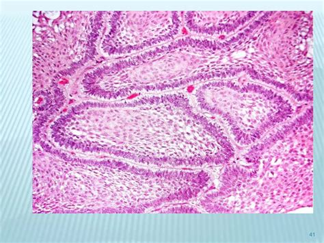 Odontogenic Tumor 2022pptx Dental Health Diseases And Conditions