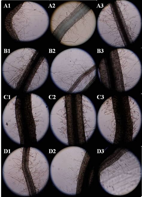 3 Visual Representation Of Root Hairs As Seen Under A Microscope With