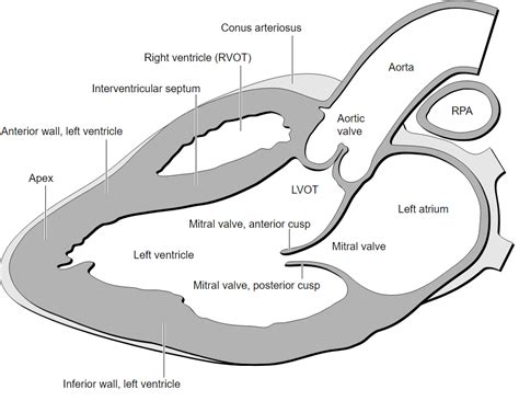 Lynch Drawing Diagram Heart In Left Parasternal Long Axis View