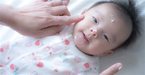 មើលថែទាំស្បែកទារក តាមវិធីសាស្រ្តងាយៗ មាតា