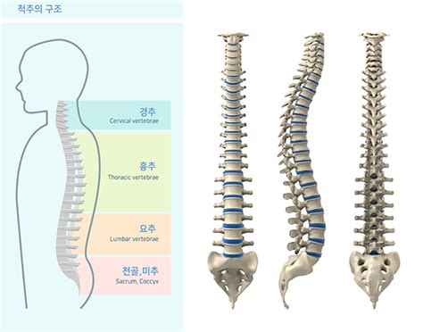 척추측만증척추옆굽음증의 종류와 증상 치료방법을 알아볼까요 네이버 블로그