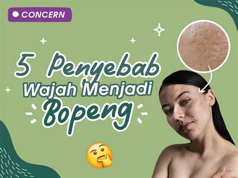 5 Penyebab Wajah Menjadi Bopeng Heystetik Heystetik