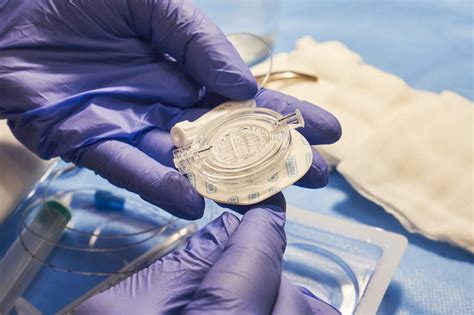 Why Is There A Global Shortage Of Epidurals Womens Health Australia