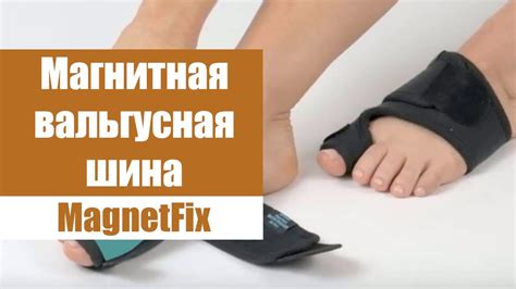 Растёт косточка на ноге возле большого пальца Youtube