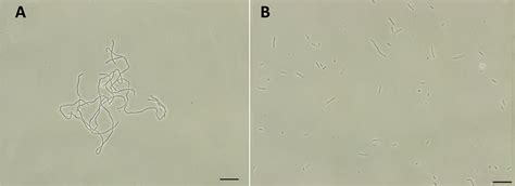 A Cells Of B Subtilis 168 Were Grown In The Presence Of 24 μg Ml⁻¹