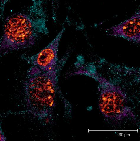 Microscopy B16 Cells