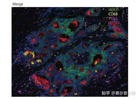 肿瘤免疫学研究新工具多重免疫组化 mIHC 知乎