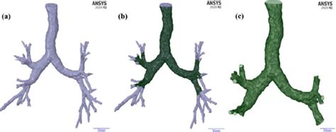 Upper Airway Geometry Anterior View Generated From Ct Image Download Scientific Diagram