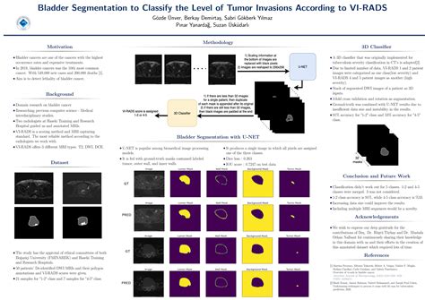Bladder Segmentation To Classify The Level Of Tumor Invasions According