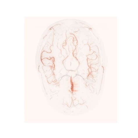 Github Soumickmj Torchesegeta Torchesegeta Interpretability And