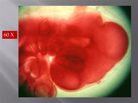 Ppt Basic Embryonic Body Plan Powerpoint Presentation Free Download