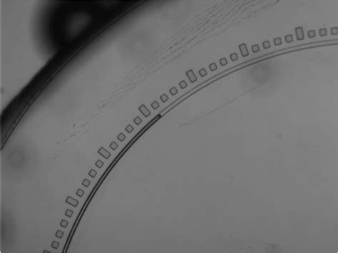 New Technology For Monitoring Glaucoma Microfluidic Implant And Smart Phone App Monitoring