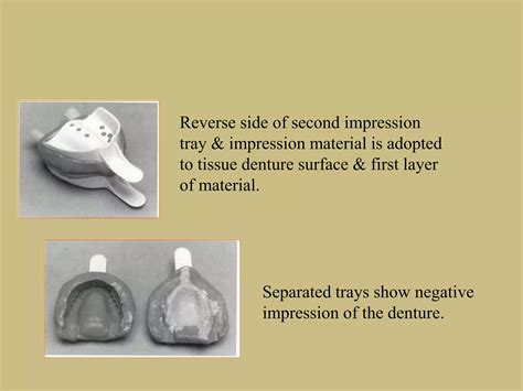 Denture Duplication 112502 Ppt