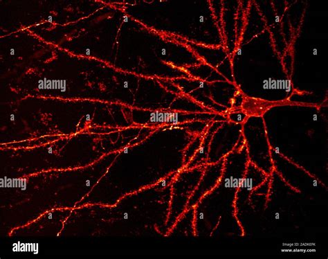 Nerve Cell Confocal Light Micrograph Of A Neurone Nerve Cell From A Human Brain The Cell