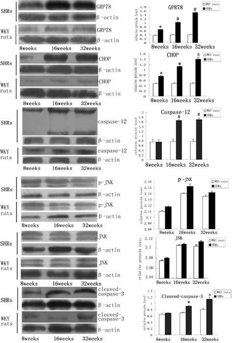 Upregulation Of The Er Stress Associated Proteins Protein Levels Of