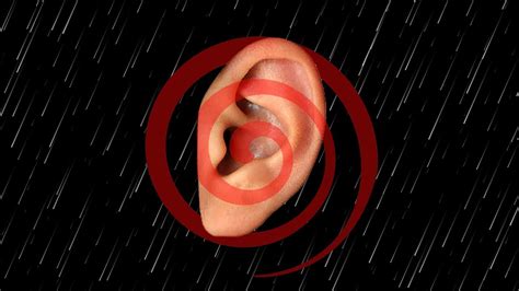 Tinnitus Sound Therapy Heavy Rain Sounds For Tinnitus Relief And