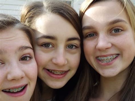 Pin By Kaleb Hughes On Orthodontic Box Cute Girls With Braces Cute