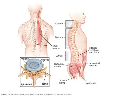 Tumor Vertebral Síntomas Y Causas Mayo Clinic