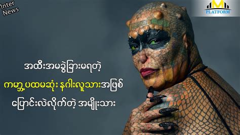 အံ့အားသင့်စရာထူးခြားတဲ့ ပြောင်းလဲမှုတွေနဲ့ ကမ္ဘာ့ပထမဆုံး နဂါးလူသား