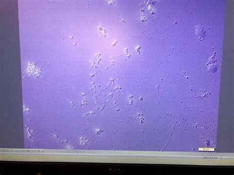 Conventional Gram Stain Reagent Preparation Crystal
