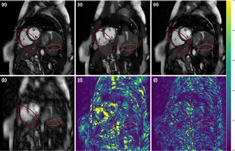 a deep cascade of convolutional neural networks for mr image reconstruction