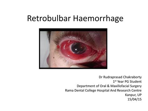 Retrobulbar Haemorrhage Pptx