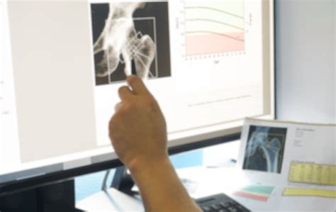 How Is A Bone Density Scan Done And How Can It Help You