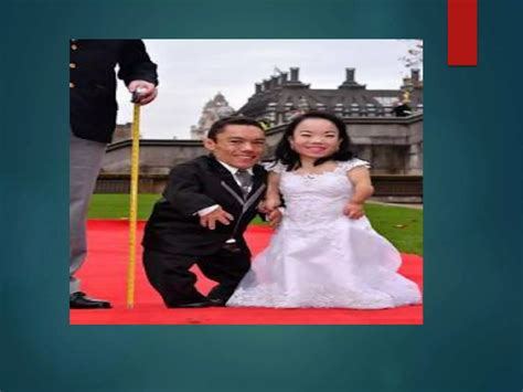 Diastrophic Dysplasia Ppt