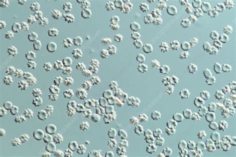 Red Blood Cells Microscope Hypertonic