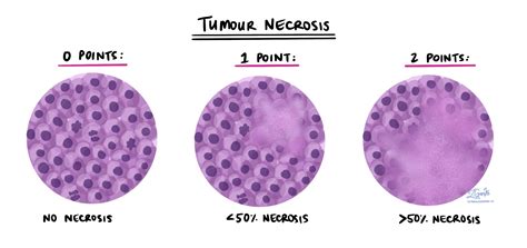 Fnclcc Fédération Nationale Des Centres De Lutte Contre Le Cancer