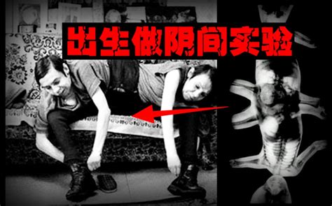 【阴间实验】用连体双胞胎做各种实验，相爱相杀的一生 郑郑得证 郑郑得证 哔哩哔哩视频