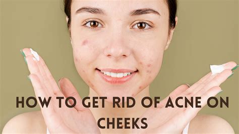 How To Get Rid Of Acne On Cheeks Healthinline