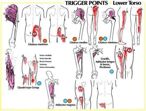 Maklumat Kesihatan Dan Penyakit Trigger Point Referral Patterns