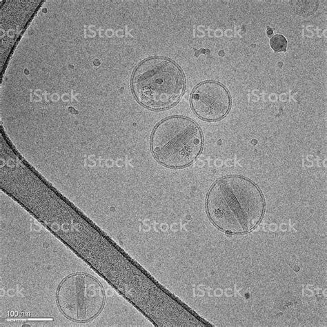 Electron Image Of Nanoparticles Made Of Lipids Containing An Anticancer