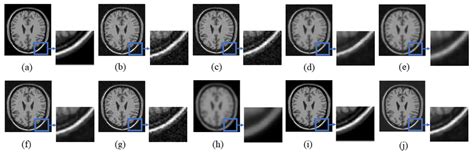 Denoising By Different Algorithms By Adding 5 Rician Noise In Mri Download Scientific Diagram