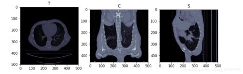 【simpleitk】胸部ct数据3d space归一化，以及3d plot simpleitk处理ct图像 csdn博客