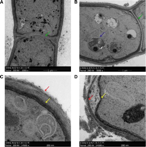 Effect Of Pyraclostrobin On Cell Ultrastructure Of Coniella Granati