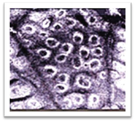 Comparison Of Reconstruction Effects A Linear Interpolation B Download Scientific Diagram