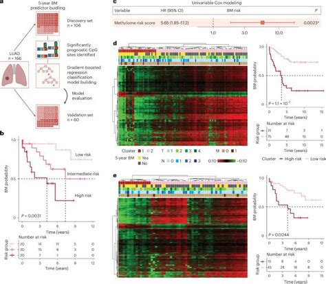 Tatiana Kerentseva On Linkedin Prediction Of Brain Metastasis