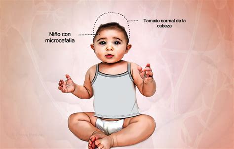 Health Condition Symptoms Causes Treatment And More