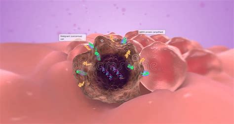 The Abnormal Gene Is Known As An Oncogene Because It Causes Tumor Growth Stock Illustration