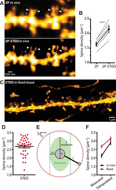 dendritic spines