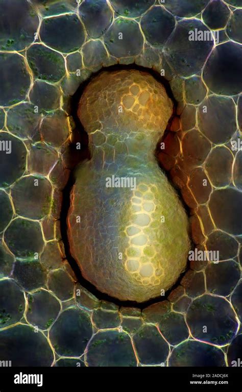 Fern Stalk Darkfield Illuminated Polarised Light Micrograph Of A