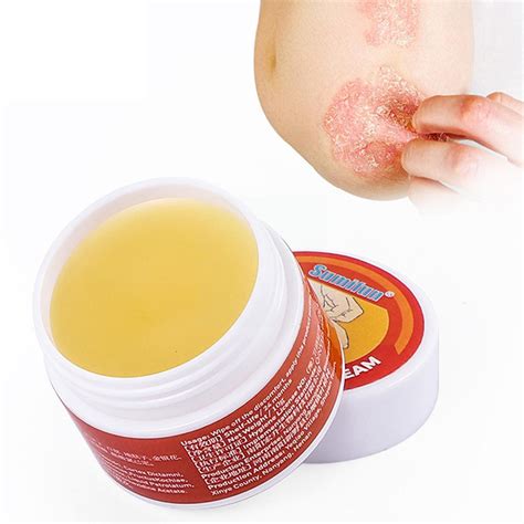 Krema za Psorijazu 50 ml – Beauty Queen