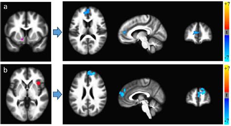 Resting State Functional Connectivity Differences Between Hiv N 21 Download Scientific