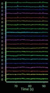 Create A Powerful EEG Chart Application With LightningChart